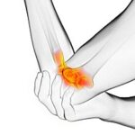 Lateral Condyle Fracture: Symptoms Causes & Treatment in Texas